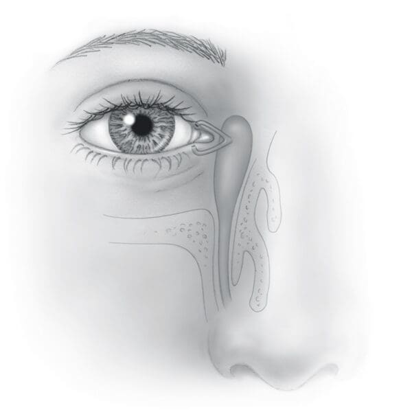 Adult Tearing | Oculofacial Society