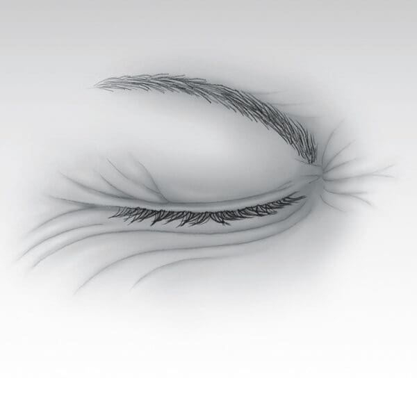 Eyelid Spasms | Oculofacial Society